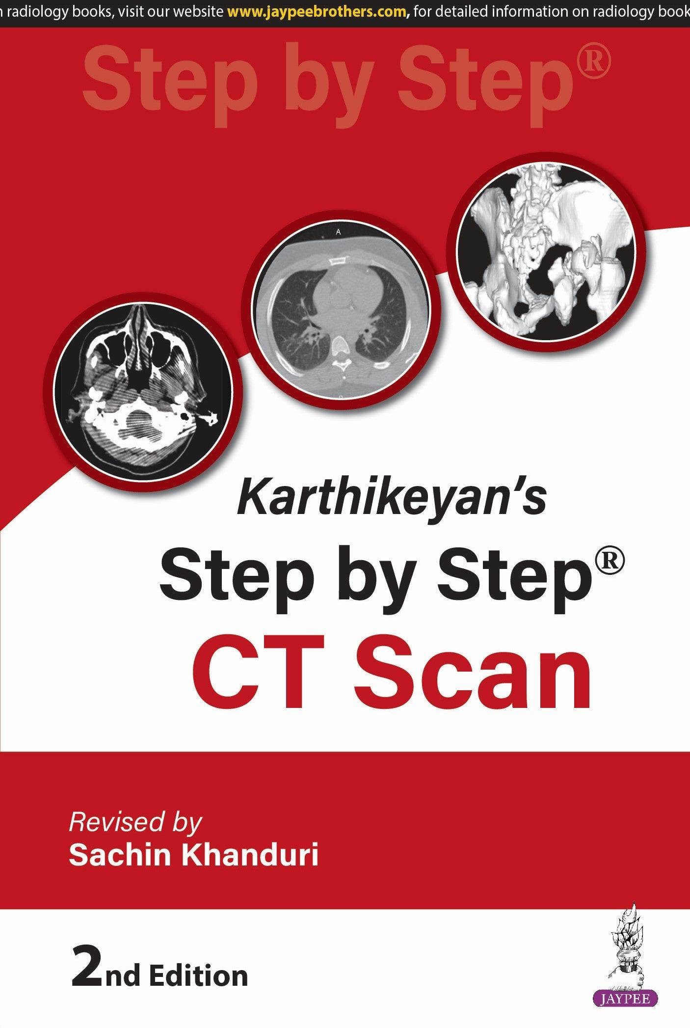 KARTHIKEYAN'S STEP BY STEP CT SCAN
